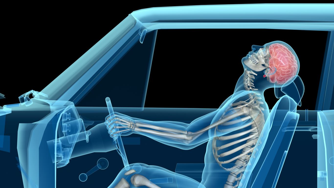 5 Reasons Why Whiplash is a Red Flag for Insurance Adjusters | Law ...